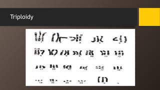 Chromosomal aberrations | PDF