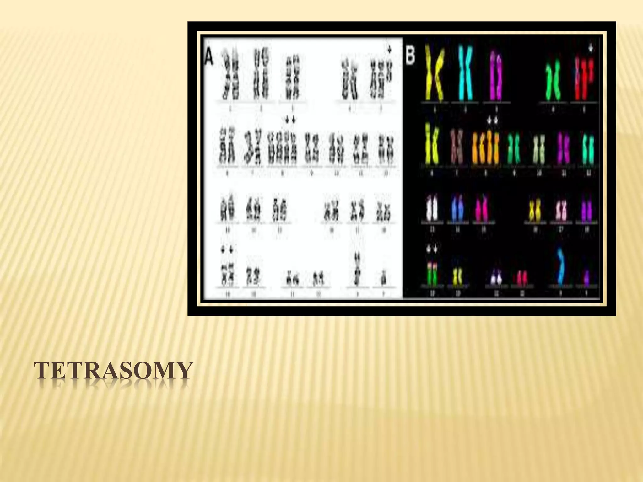 Chromosomal aberrations | PPTX