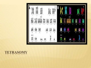 Chromosomal aberrations | PPTX