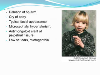 Chromosomal aberrations,downs syndrome-Dr.Gourav | PPTX