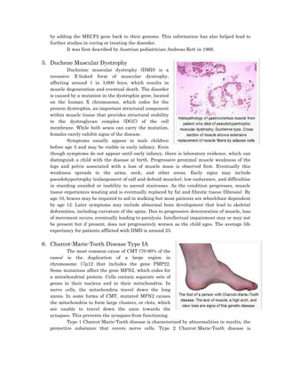 Chromosomal aberration syndrome biology | DOCX