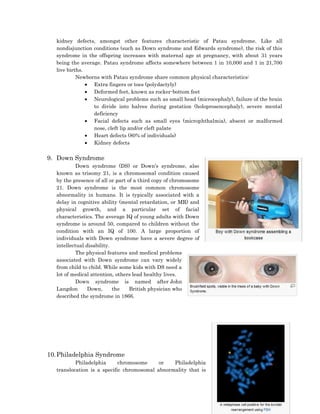 Chromosomal aberration syndrome biology | DOCX
