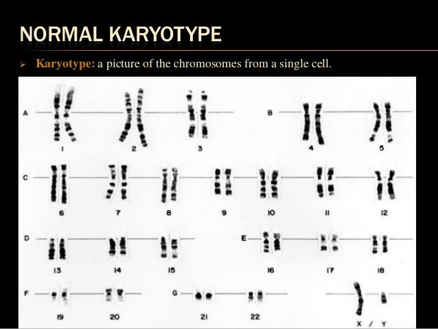 Chromosomal abnormalities