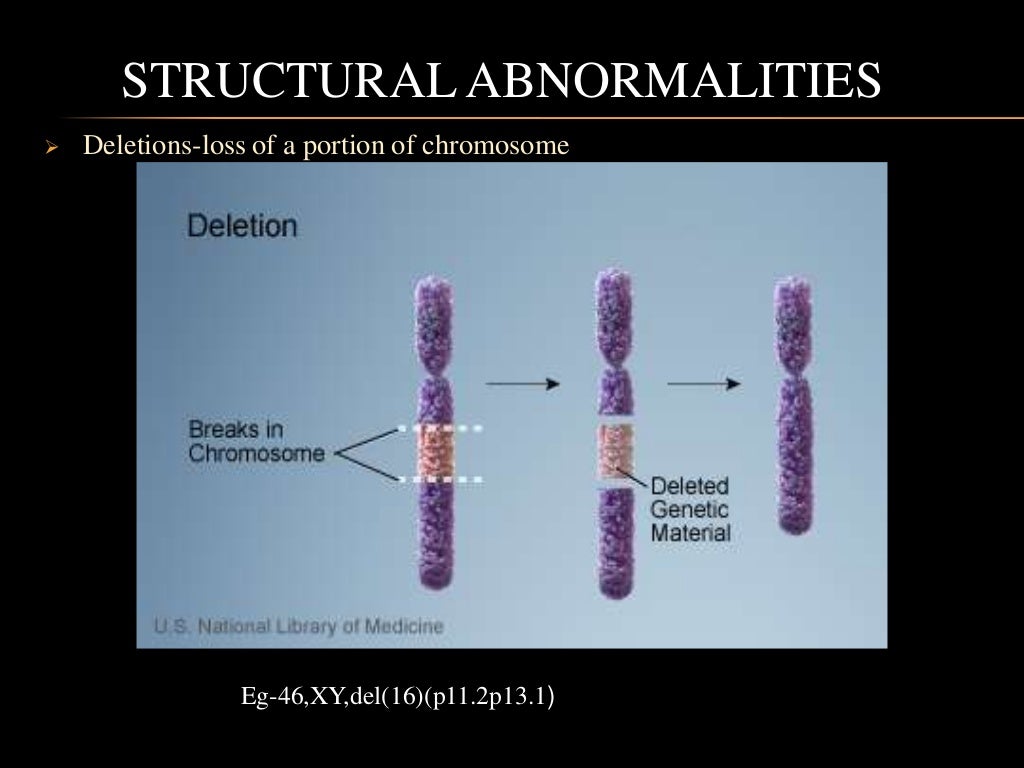 Chromosomal abnormalities
