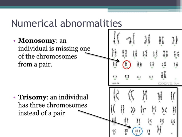 Chromosomal abnormalities | PPTX
