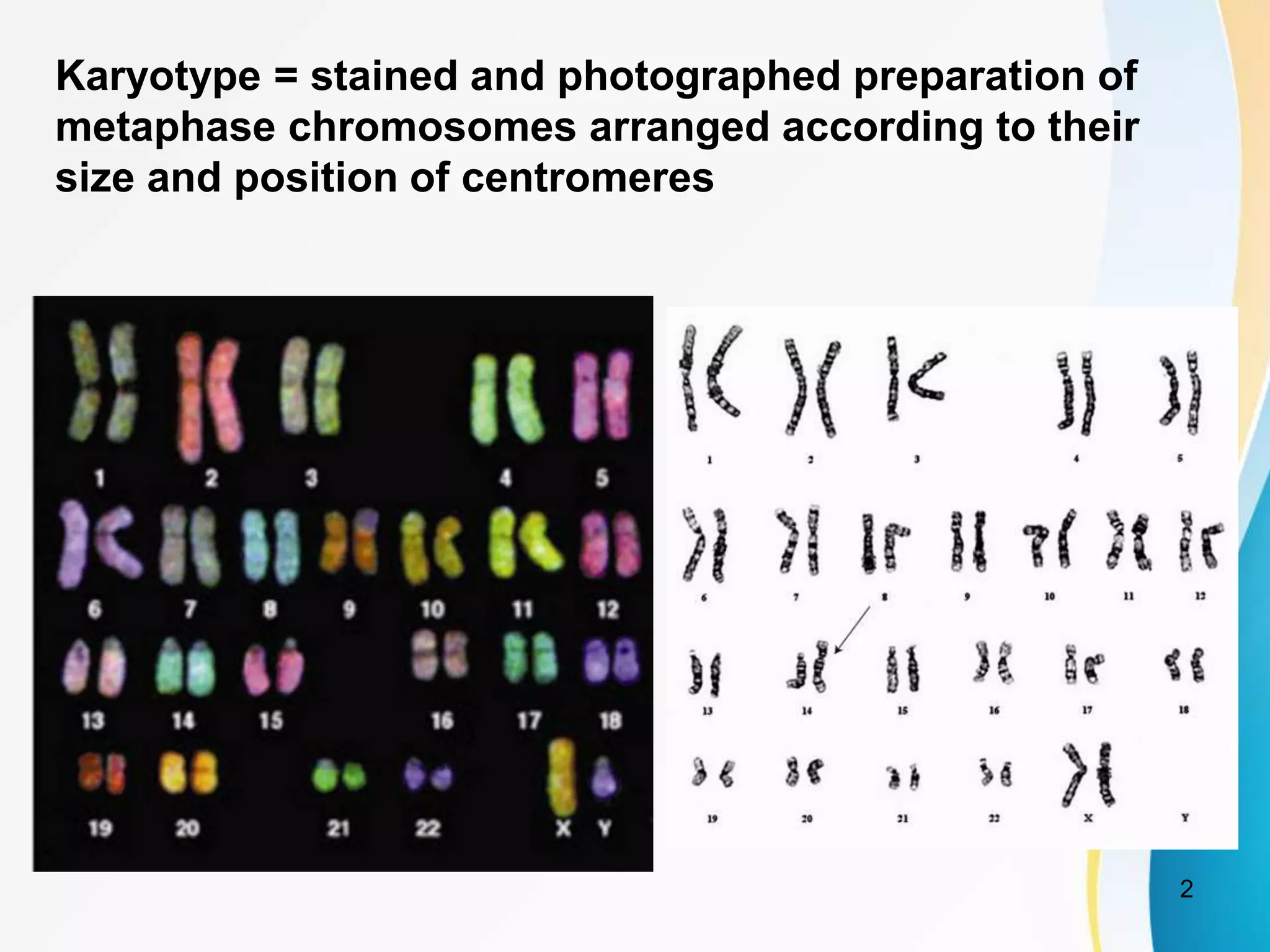 chromosomal abnormalities.ppt