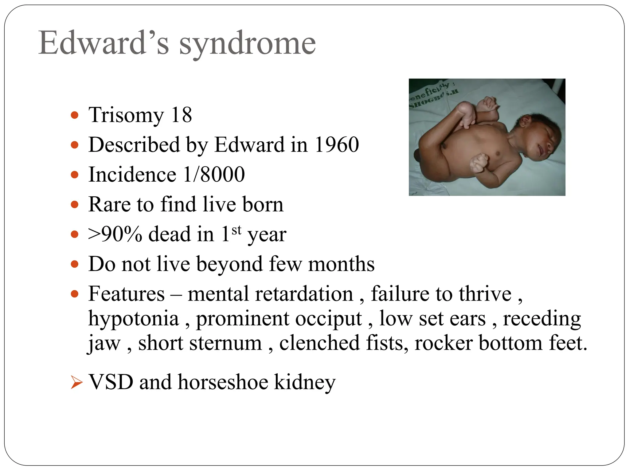 Chromosomal Abnormalities-Sasi-converted.pdf