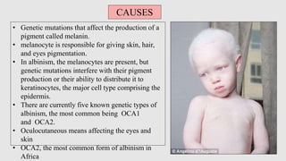 Chromosomal and genetic disorders | PPTX