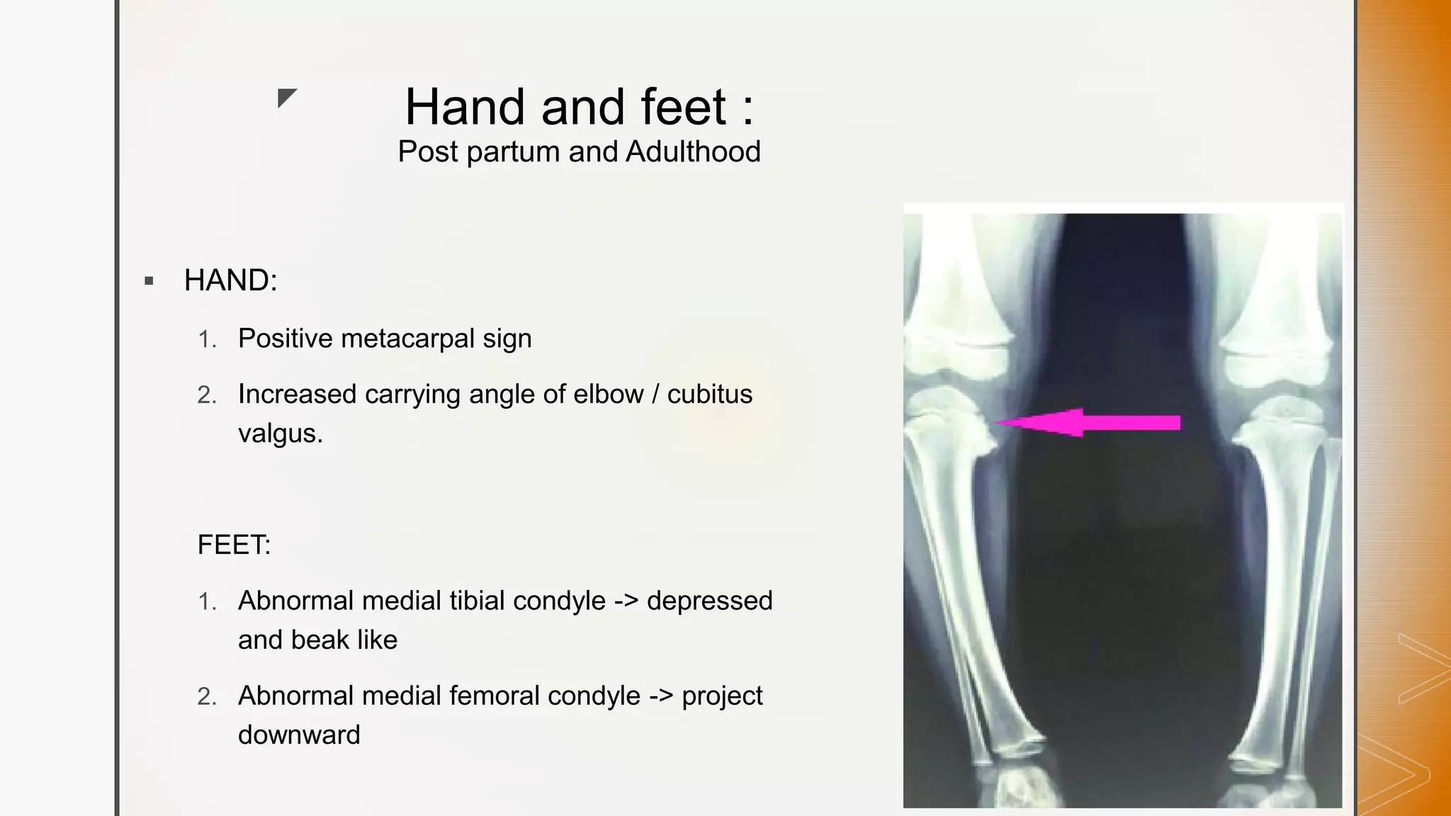 chromosomal anomalies.pptx