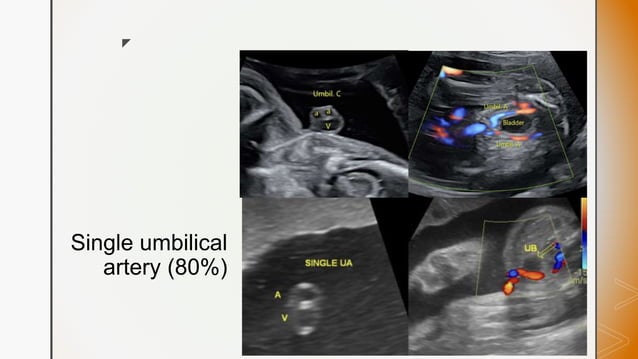 chromosomal anomalies.pptx