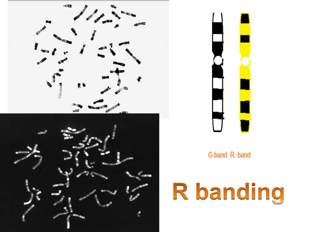Chromosomal banding technique | PPT