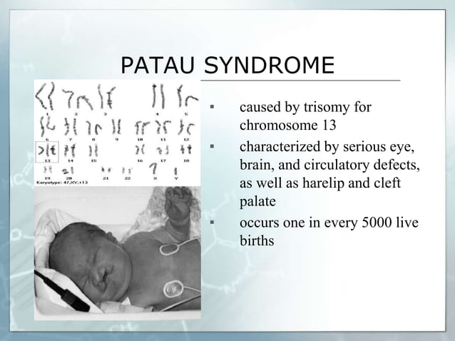 Chromosomal Basis Of Inheritance Pptx