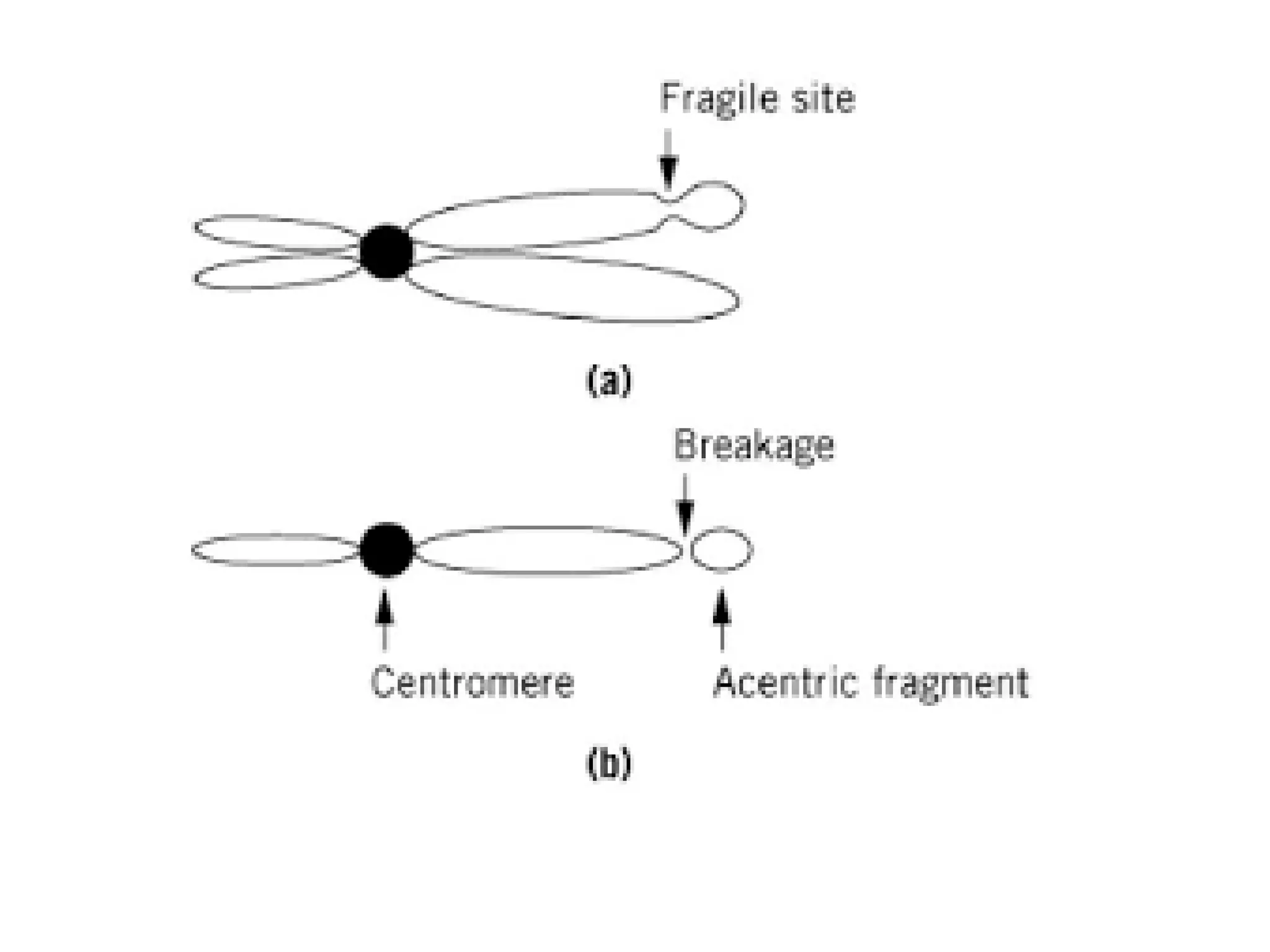 Chromosomal brekage syndrome | PPT