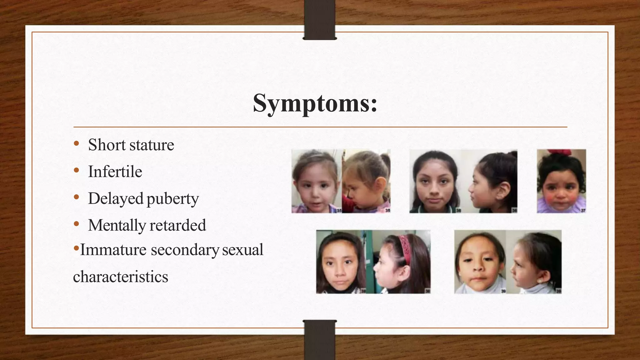 chromosomal disease.pptx
