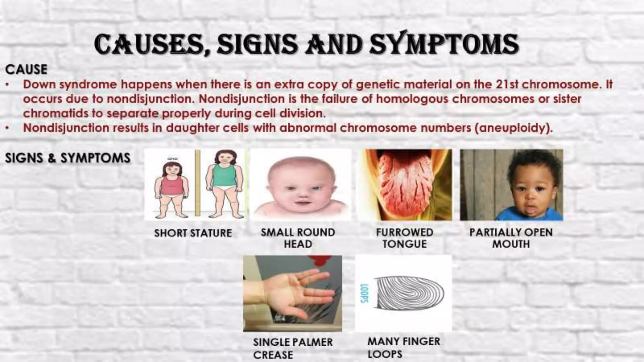 Chromosomal disorders | PPT