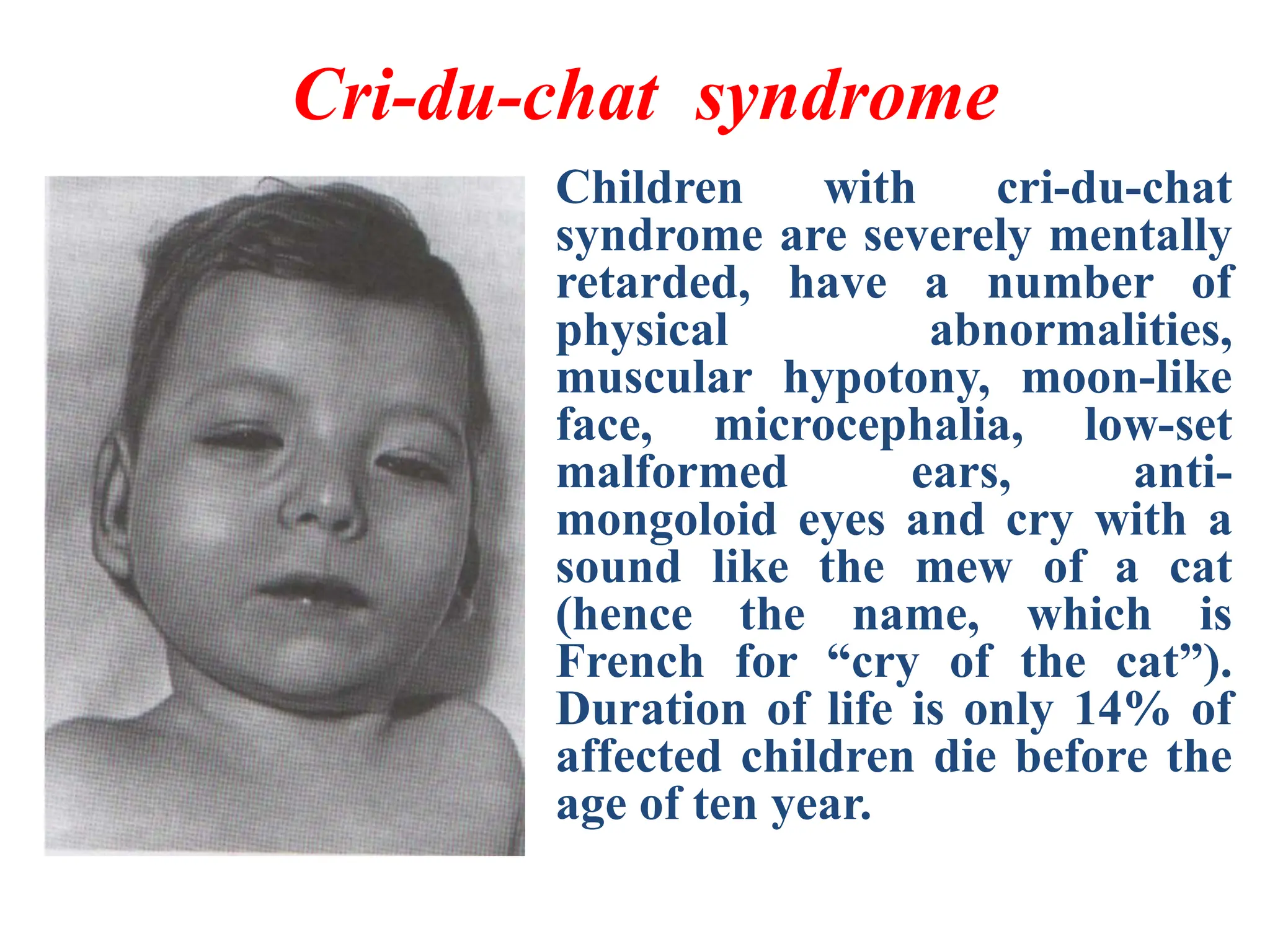 chromosomal disorders of the human body.ppt