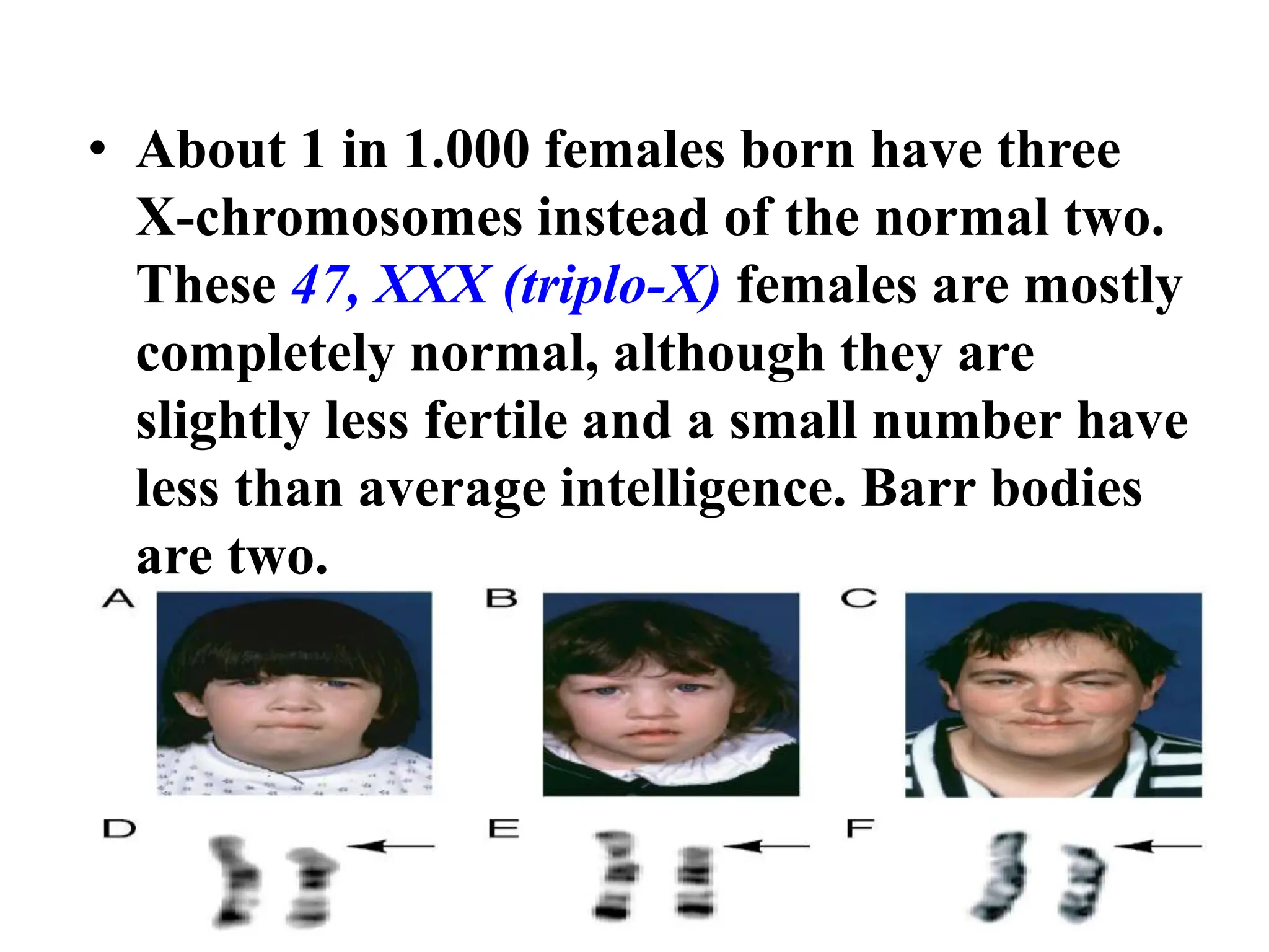 chromosomal disorders of the human body.ppt