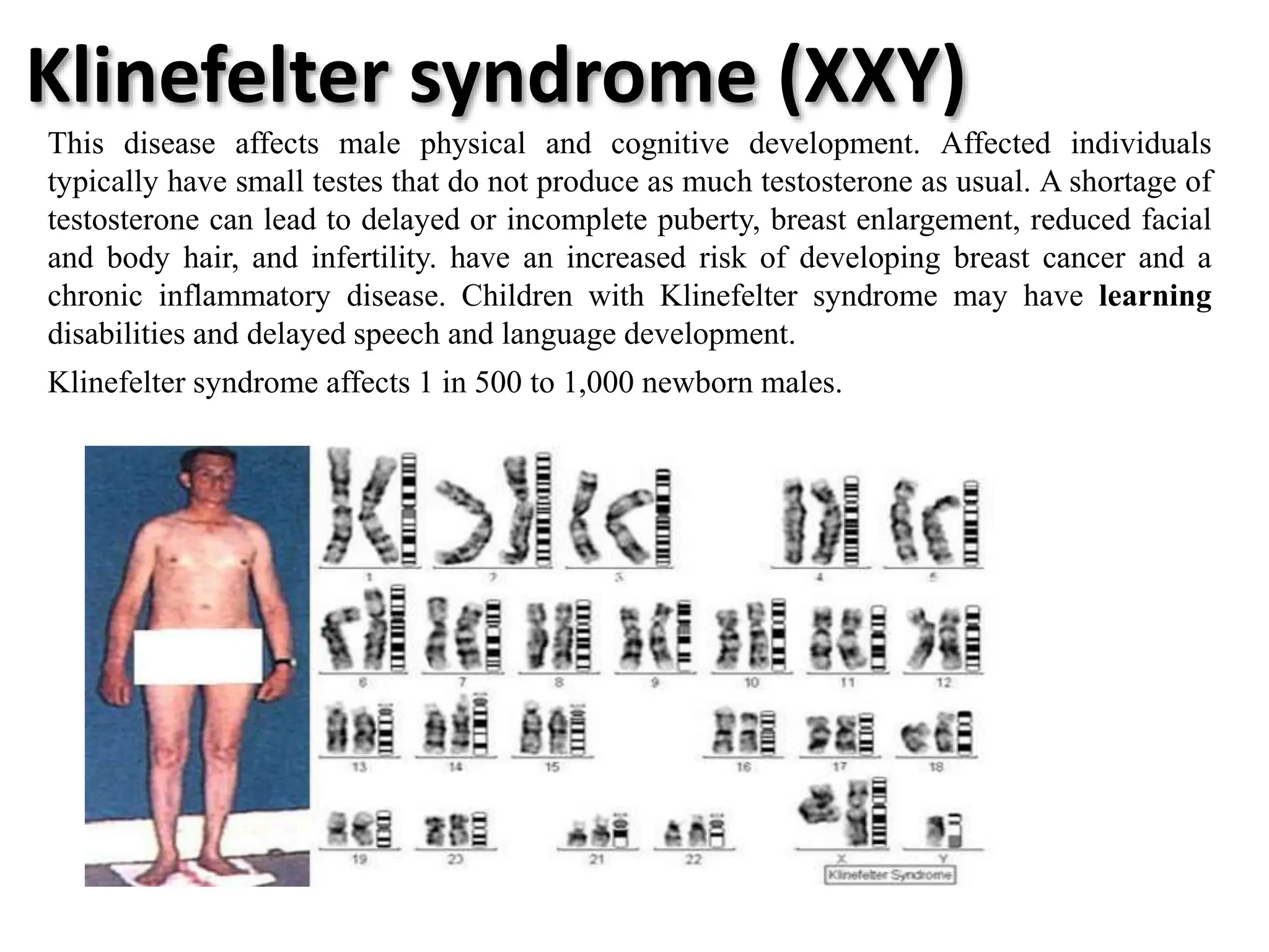 chromosomal disorders of the human body.ppt