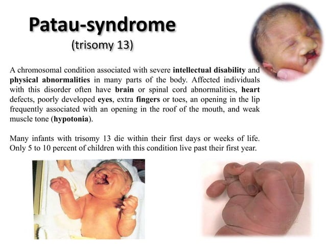 chromosomal disorders of the human body.ppt