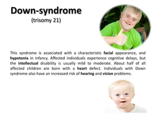chromosomal disorders of the human body.ppt