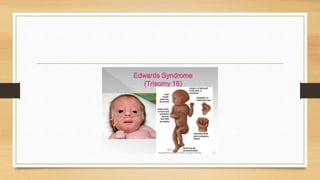 Chromosomal mutation/class 12 biology | PPTX