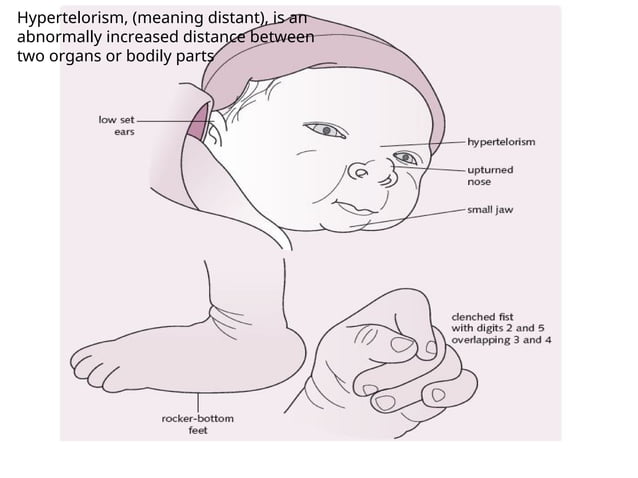 Chromosomal Mutations II (Entire Set of Chromosome) | PPT