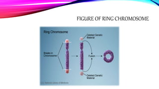 Structural Chromosome aberration ppt | PPTX