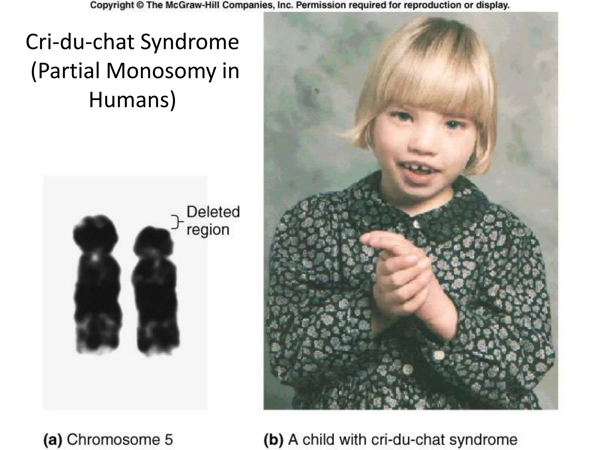 Types of Chromosome Aberrations or abnormalities.pptx