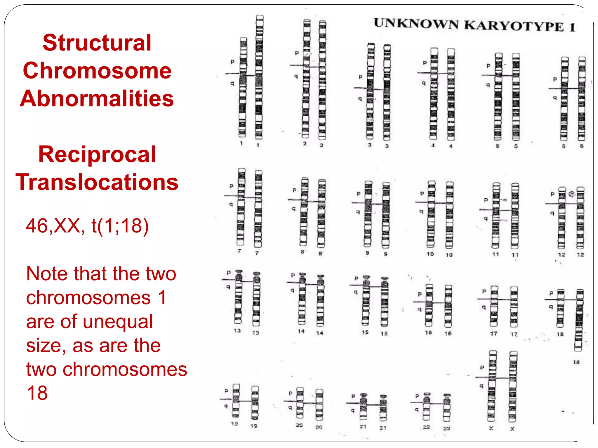 Chromosome disorders.pptx