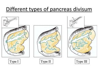 Chronic pancreatitis in children | PDF