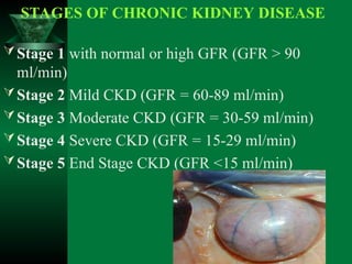 chronic-kidney-disease-medical-surgical-nursing-ppt.ppt