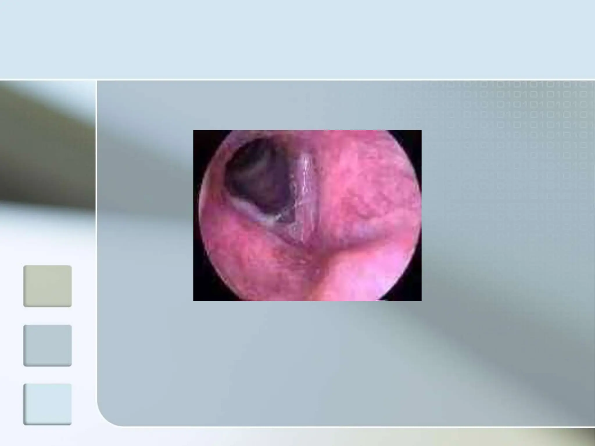 Chronic-laryngitis, causes and management | PPT