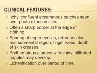 Chronic Actinic Dermatitis