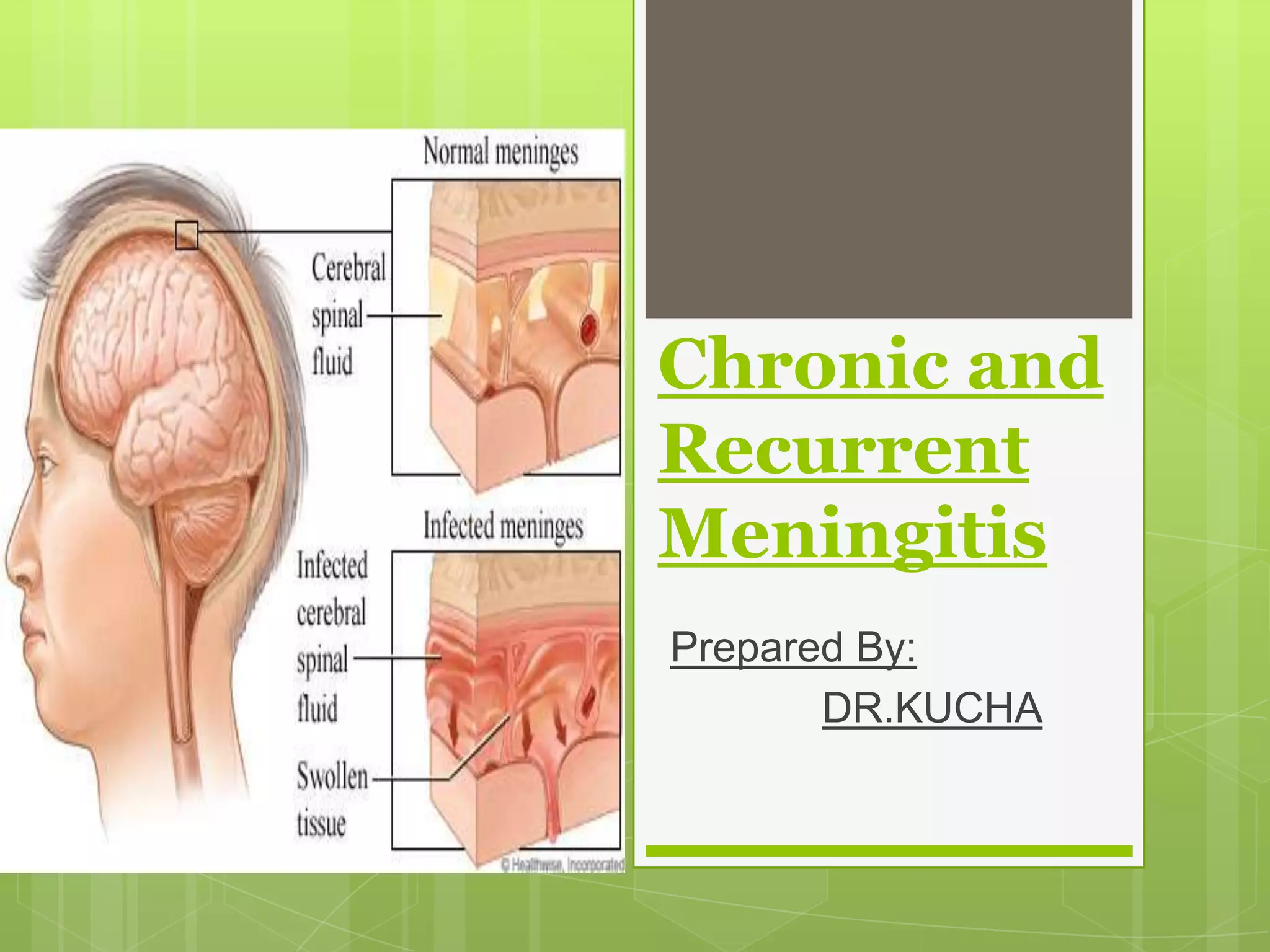 Chronic and recurrent meningitis | PPTX