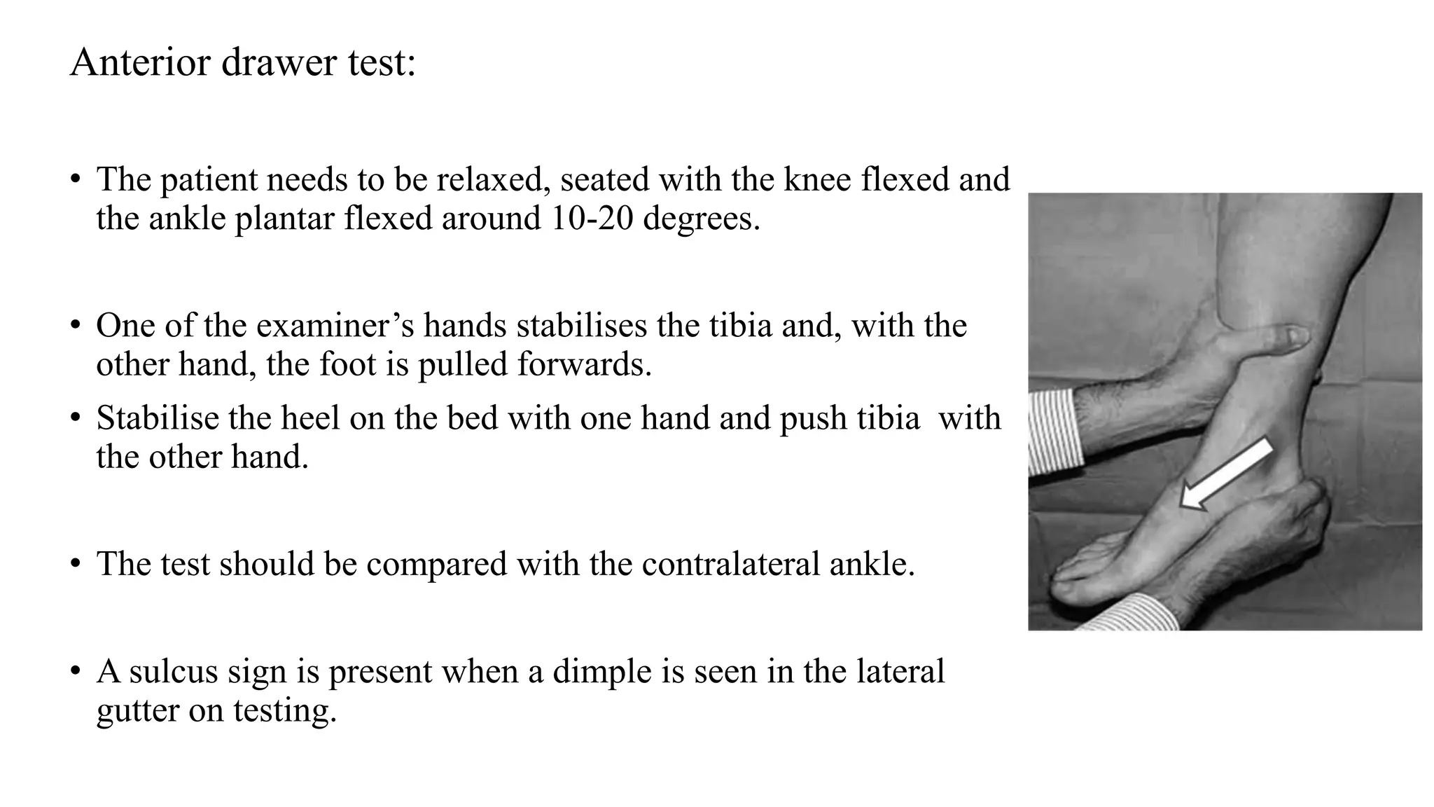 Chronic ankle instability | PPTX