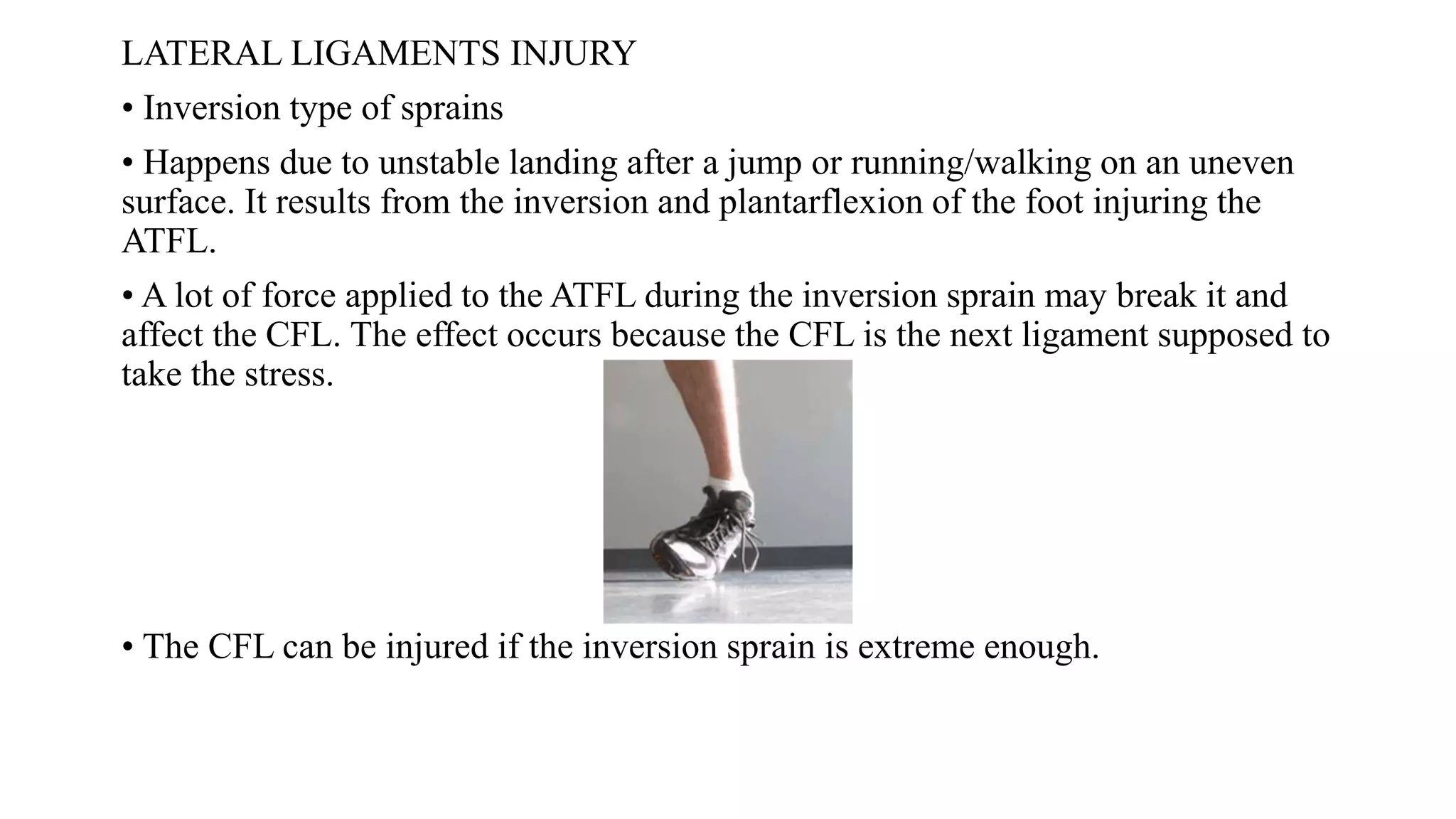 Chronic ankle instability | PPTX
