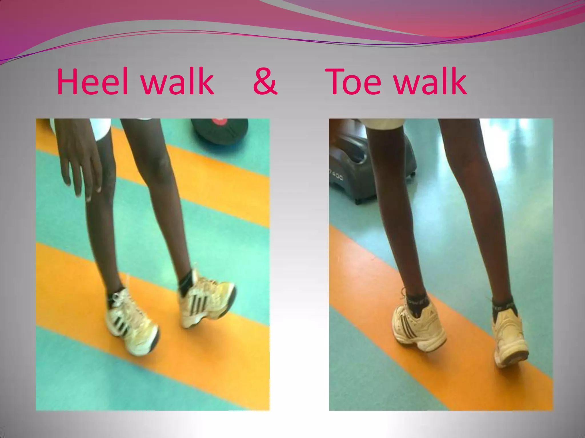 Chronic ankle sprain | PPT