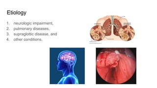 Chronic aspiration Chronic aspiration causes | PDF
