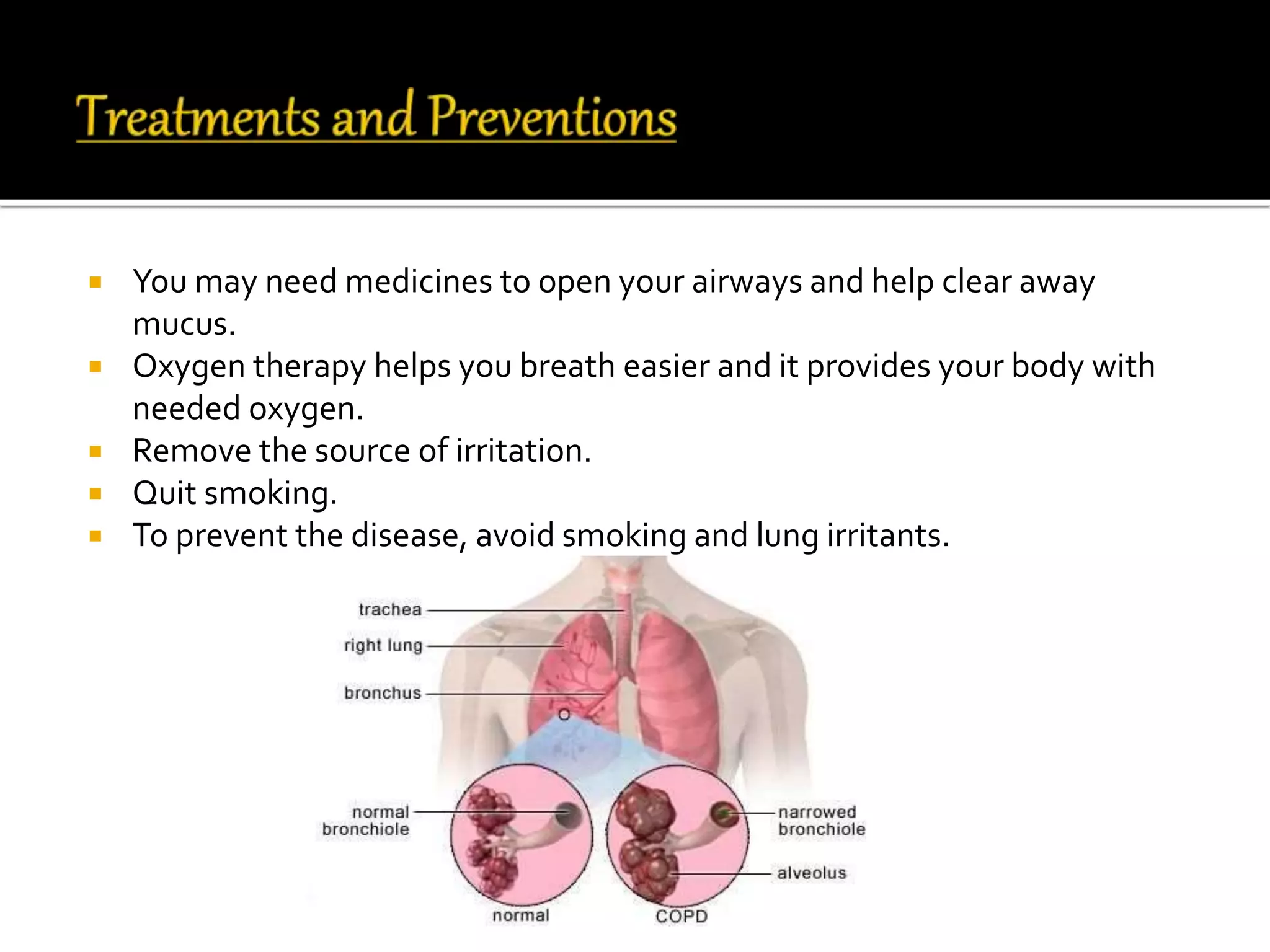 Chronic Bronchitis | PPTX