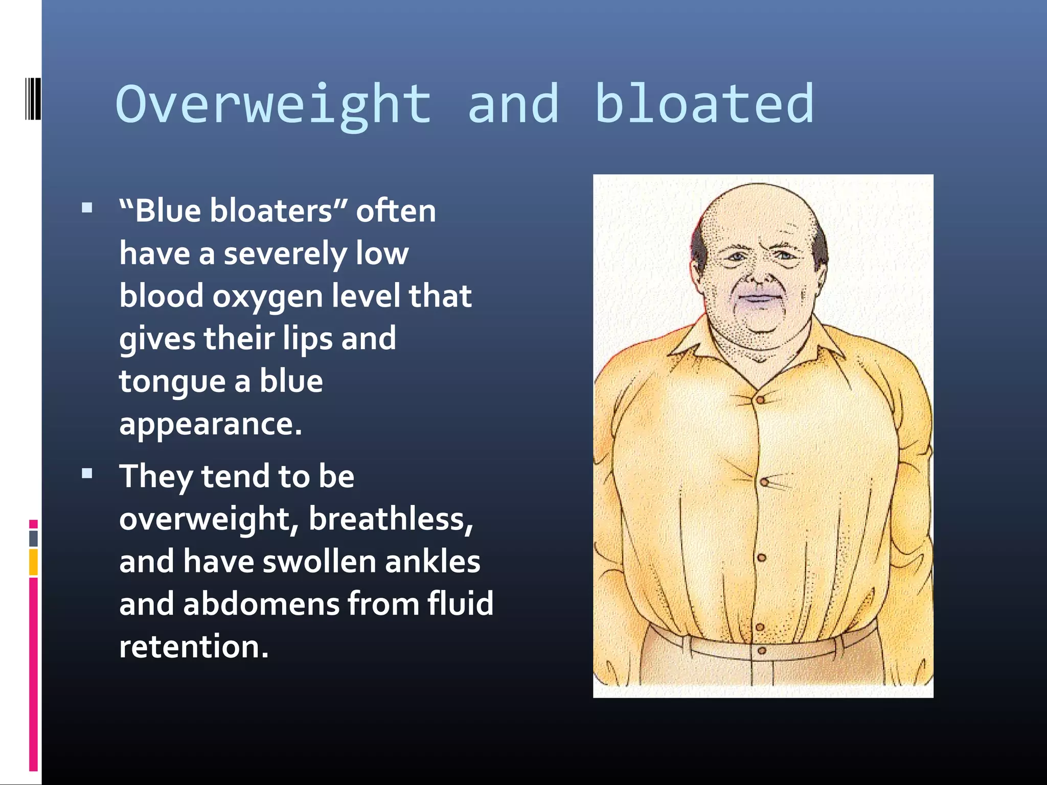 Chronic Bronchitis | PPT