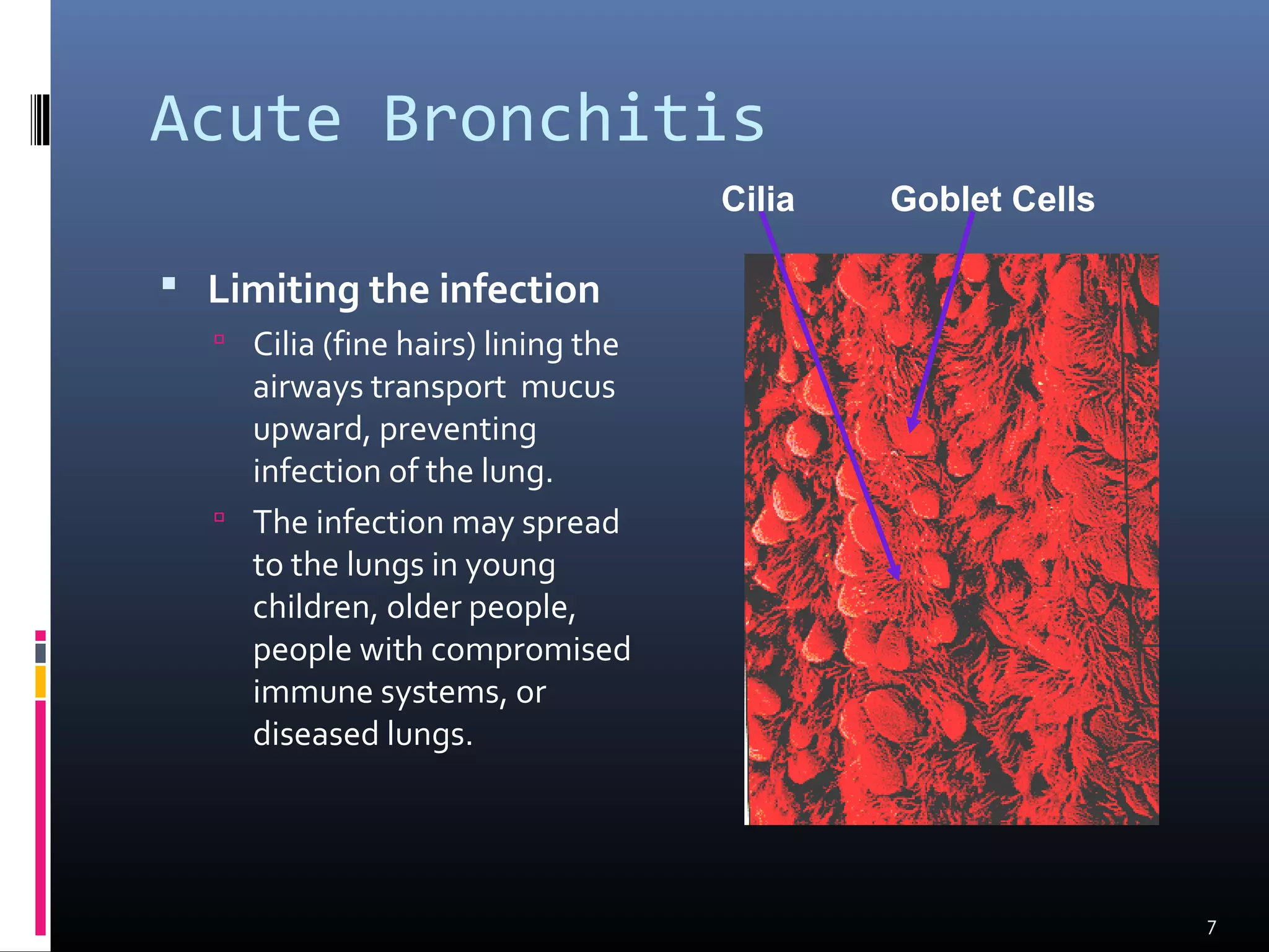 Chronic Bronchitis | PPT