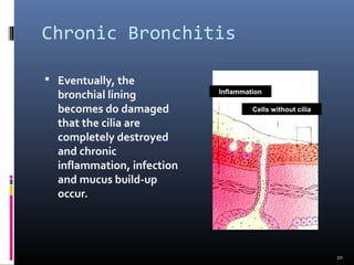 Chronic Bronchitis | PPT