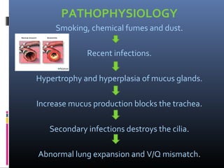 Chronic Bronchitis | PPT