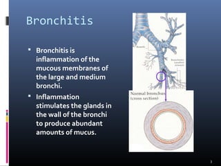 Chronic Bronchitis | PPT