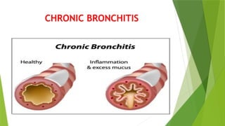 chronic bronchitis.causes and risk factors, signs and symptoms ...