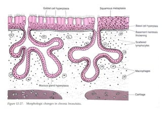 Chronic Bronchitis Histology