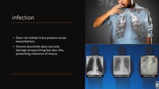 Chronic bronchitis(COPD).pptx