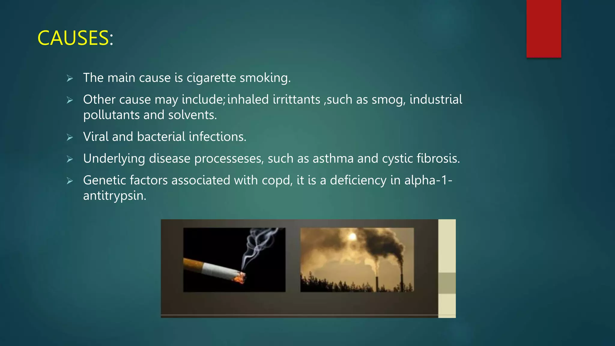 CHRONIC BRONCHITIS | PPTX