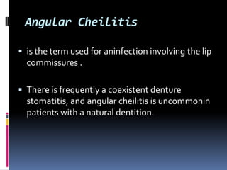 Chronic candidiasis | PPTX | Dental Health | Diseases and Conditions