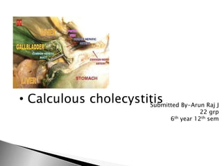chroniccholecystitis-120811101403-phpapp01.pptx